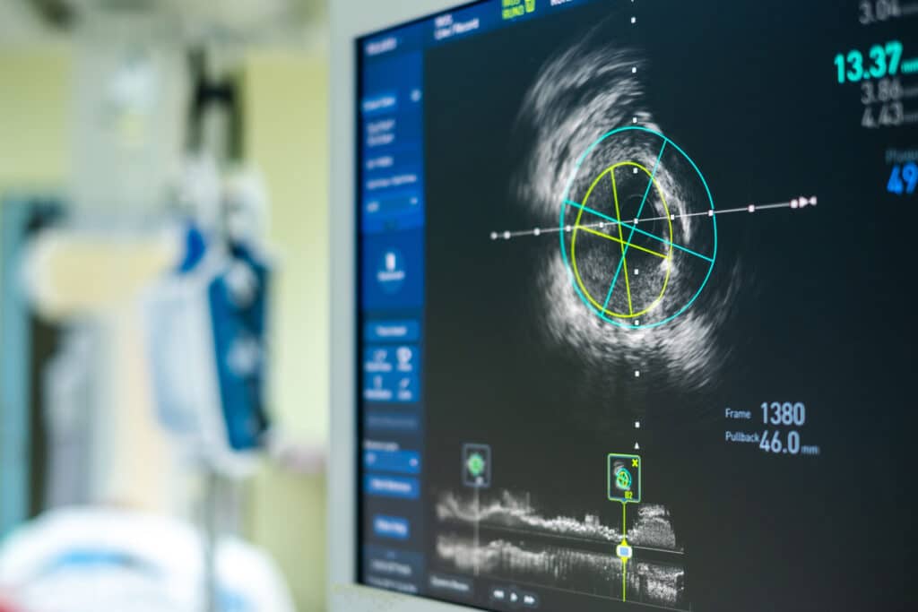 Advanced Cardiovascular Imaging - Southcoast Health Heart & Vascular